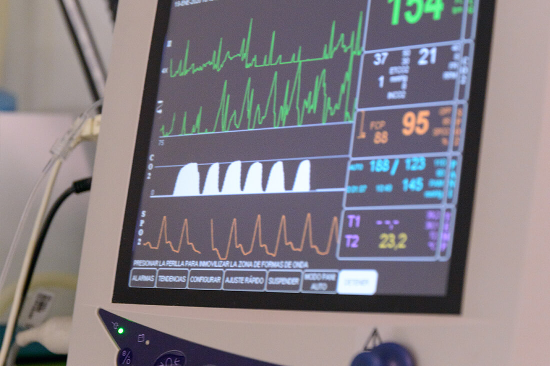 Electrocardiogramas - Eliavet, tu clínica veterinaria